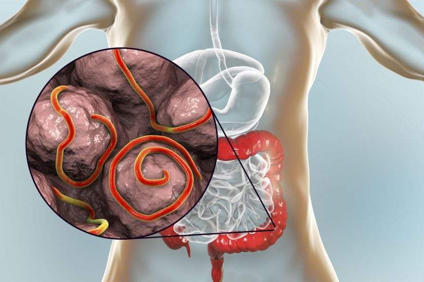 Oxiuri - 10 Remedii ce pot trata infectia - Sănătate NON-STOP